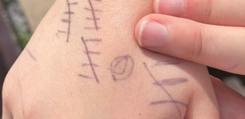 My son came home from school with marks all over his hand… I was ...