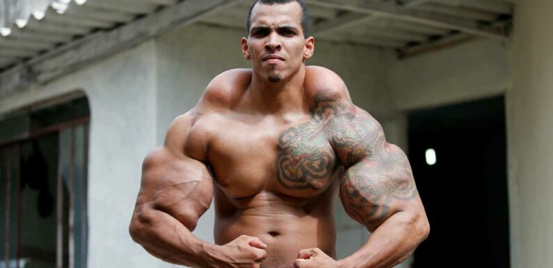 I was a real-life Hulk with oil-injected ‘double muscle’ biceps full to ...