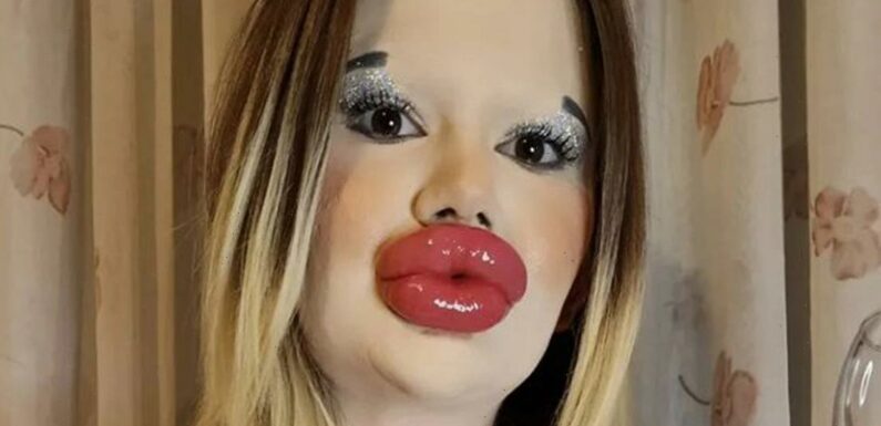 I’m a plastic surgery fanatic with ‘world’s biggest lips’ - but now I’m ...